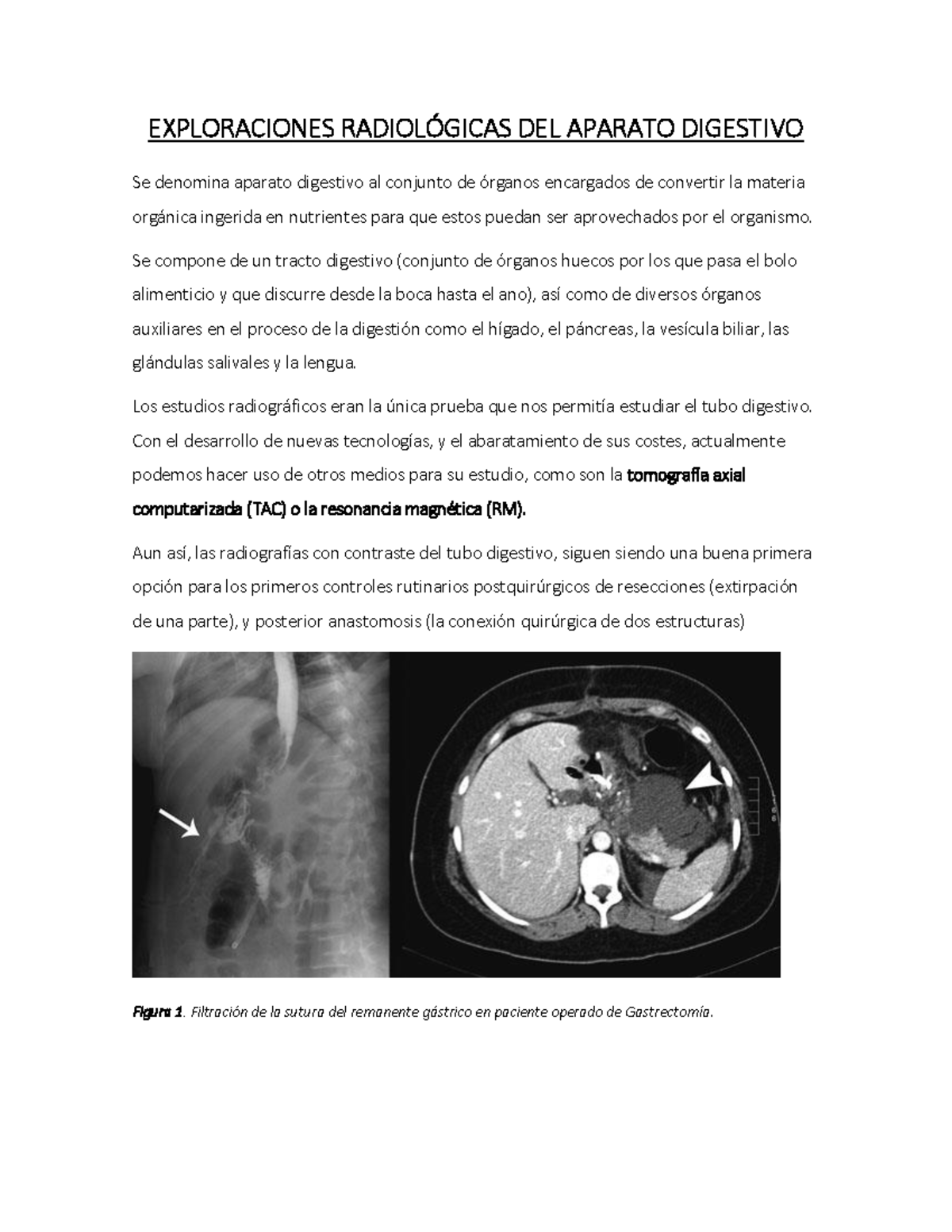 Tema Ap digestivo - EXPLORACIONES RADIOLÓGICAS DEL APARATO DIGESTIVO Se ...
