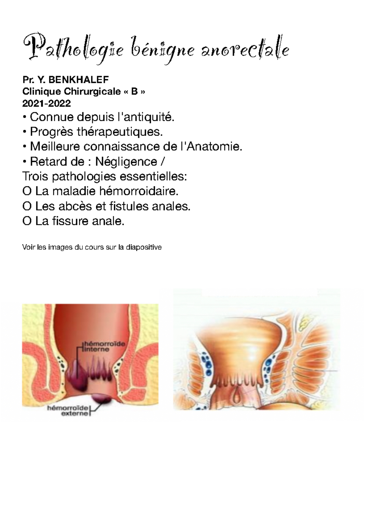 Gastrologie pathologie benigne anorectale 2022 - Pathologie bénigne ...