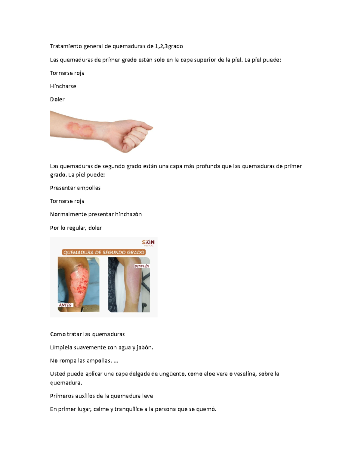 Tratamiento general de quemaduras de 1 - La piel puede: Tornarse roja ...