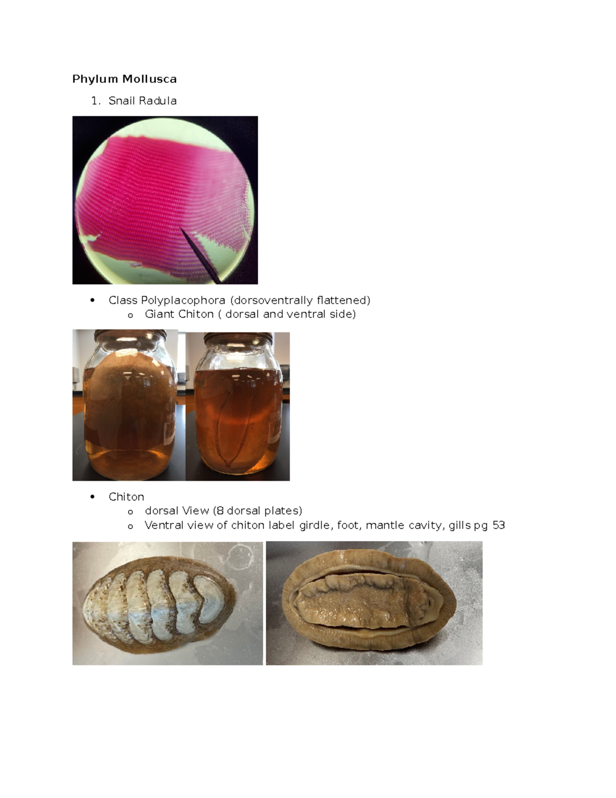 Phylum Mollusca - Snail Radula Class Polyplacophora (dorsoventrally ...
