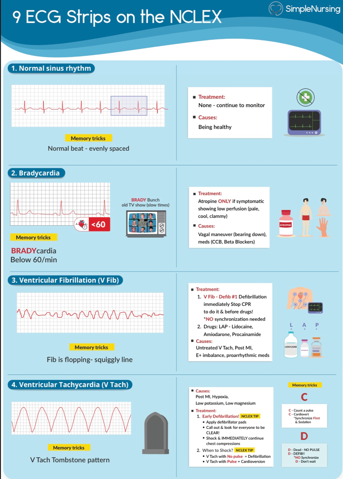 Cardiac Rhythms - 5. Atrial Fibrillation (A Fib) - . . -. - Memory ...