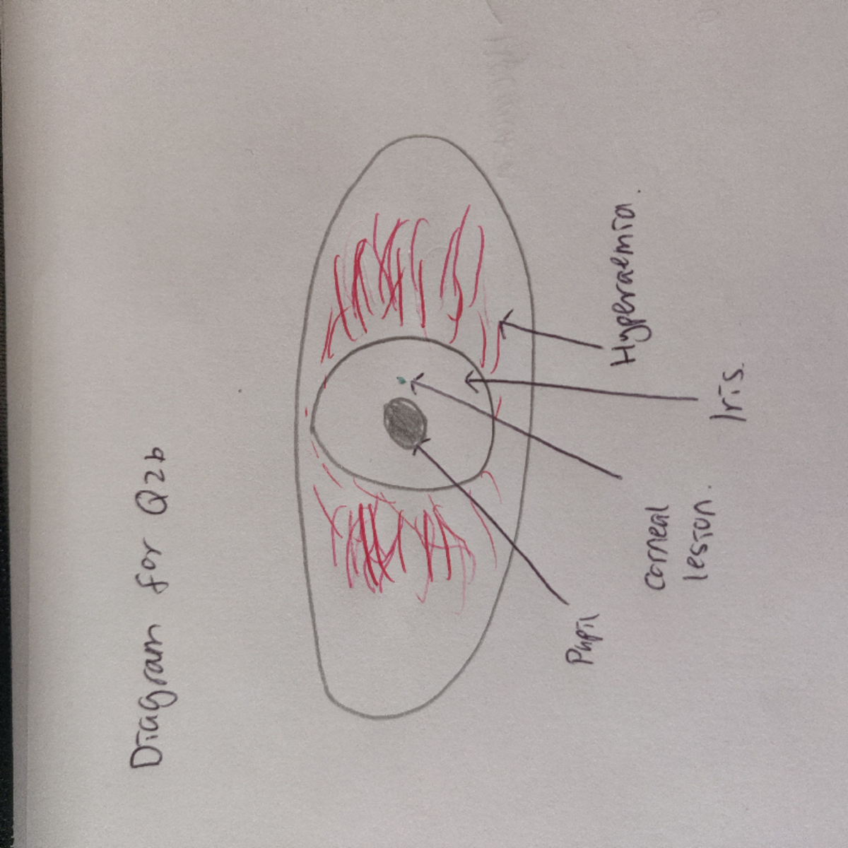 Corneal lesion and hyperaemia hand drawn diagram - M3B525791 - Studocu