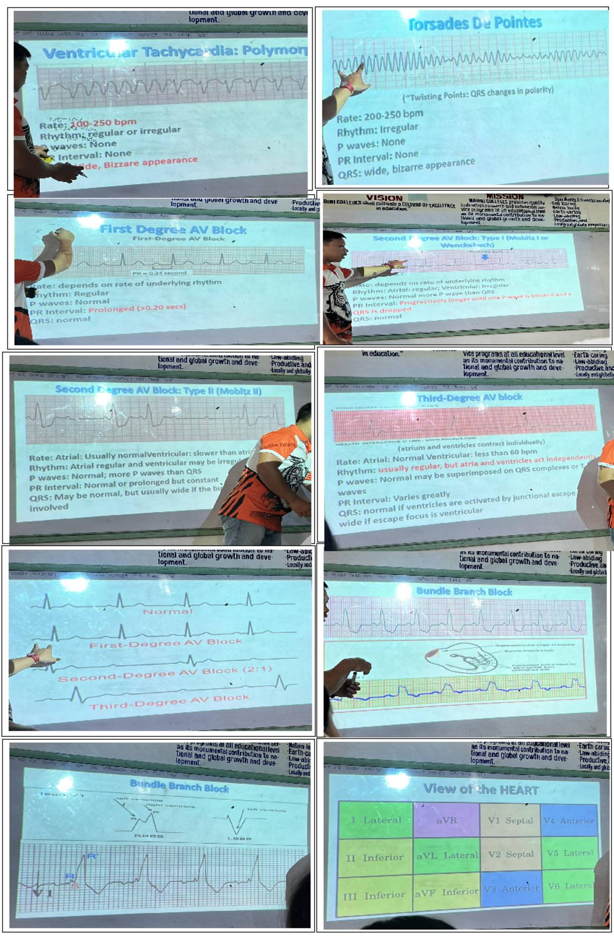 Ecg4 - 123456789 - fundamentals of nursing - Studocu