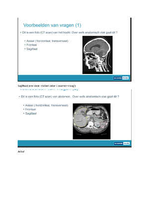 Hormonen - Hormonen Oxytoxine = glad spierweefsel in uterus, melk ...