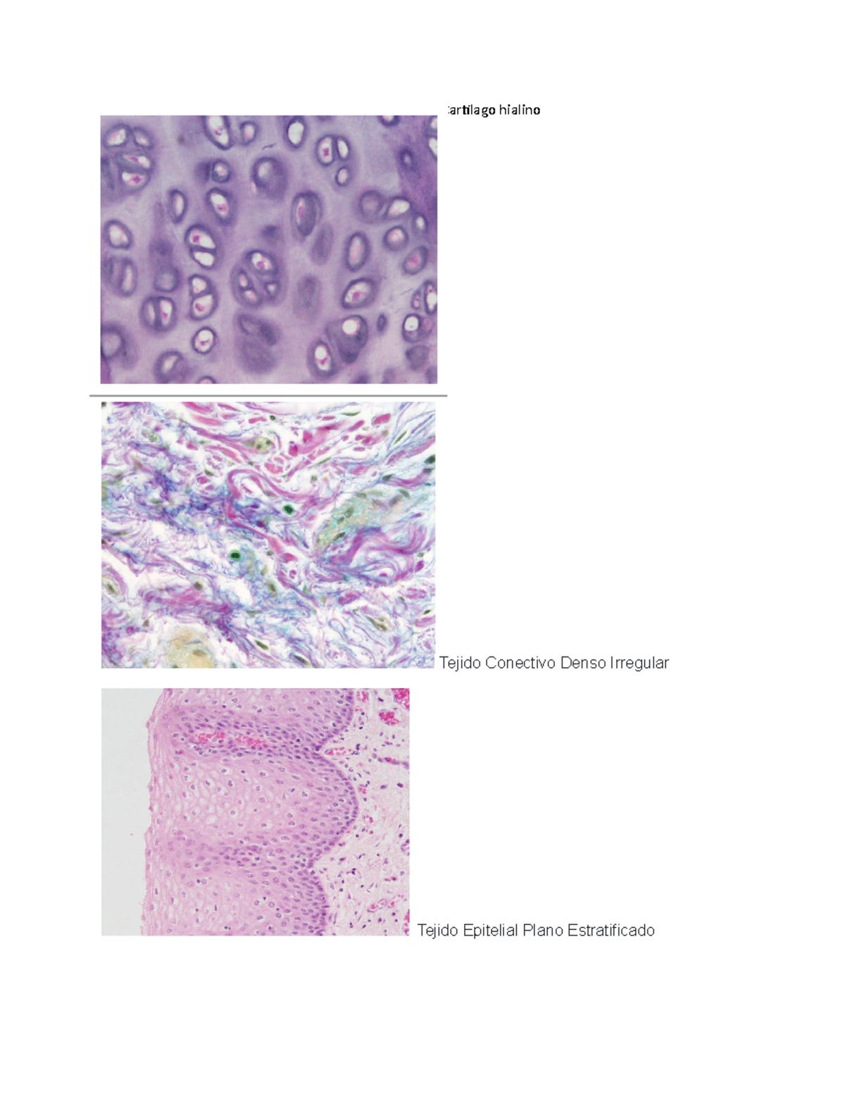 Plaquitas primer parcial repaso 1 - Cartilago hialino Tejido Conectivo ...