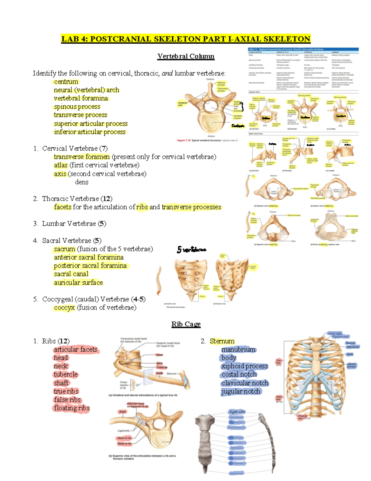 Lab quizzes 3 - Lab 3 anatomical terms: spine and spinous features - 13 ...