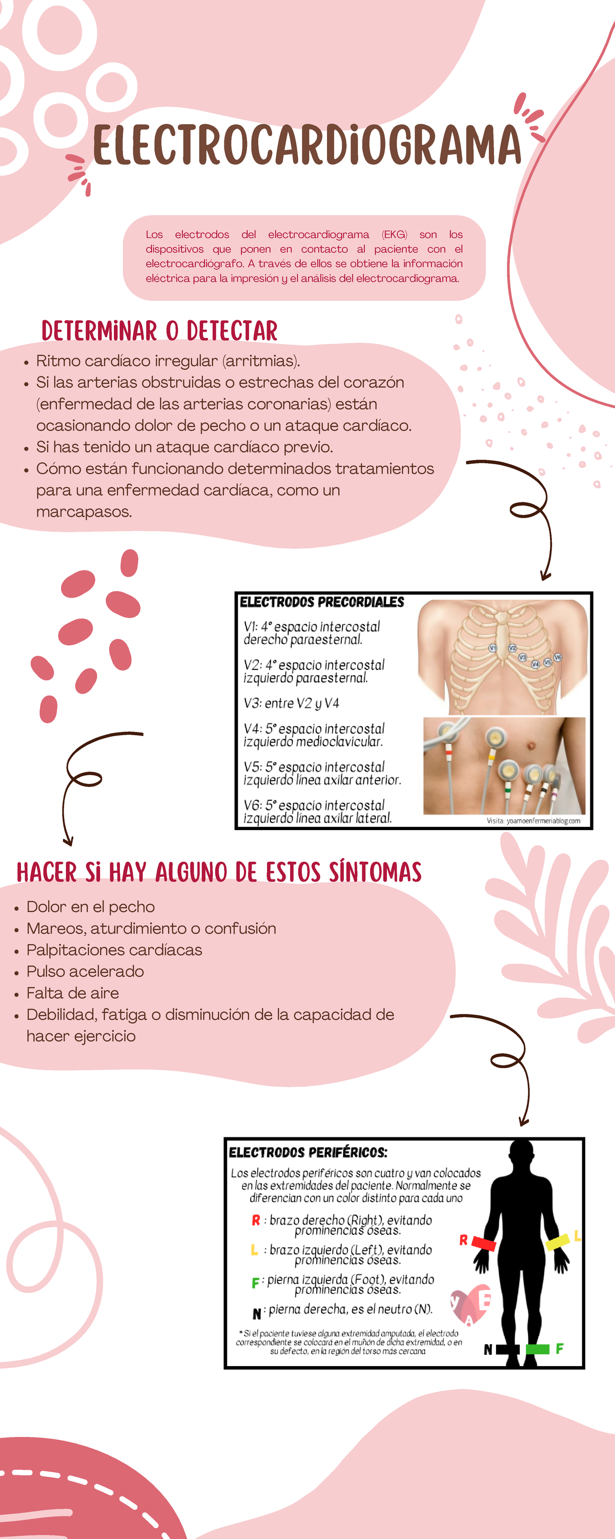 Infografía electrocardiograma - electrocardiograma Los electrodos del ...