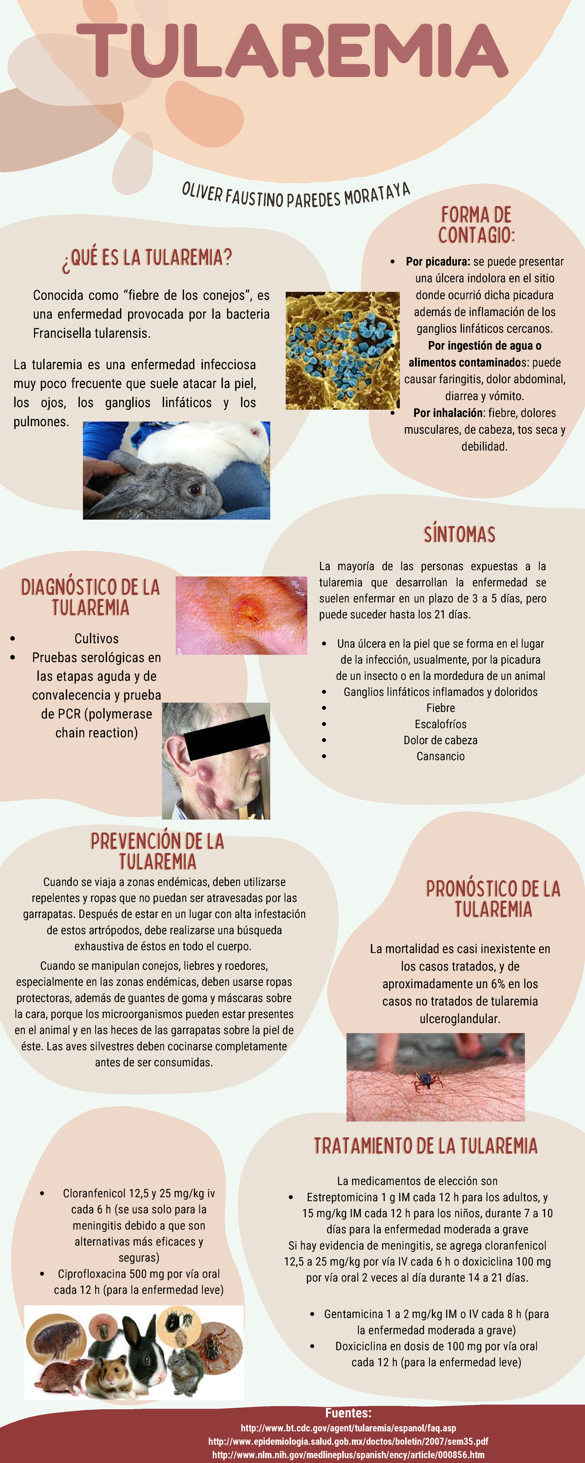 Tularemia - TULAREMIATULAREMIATULAREMIA ¿QUÉ ES LA TULAREMIA?¿QUÉ ES LA ...