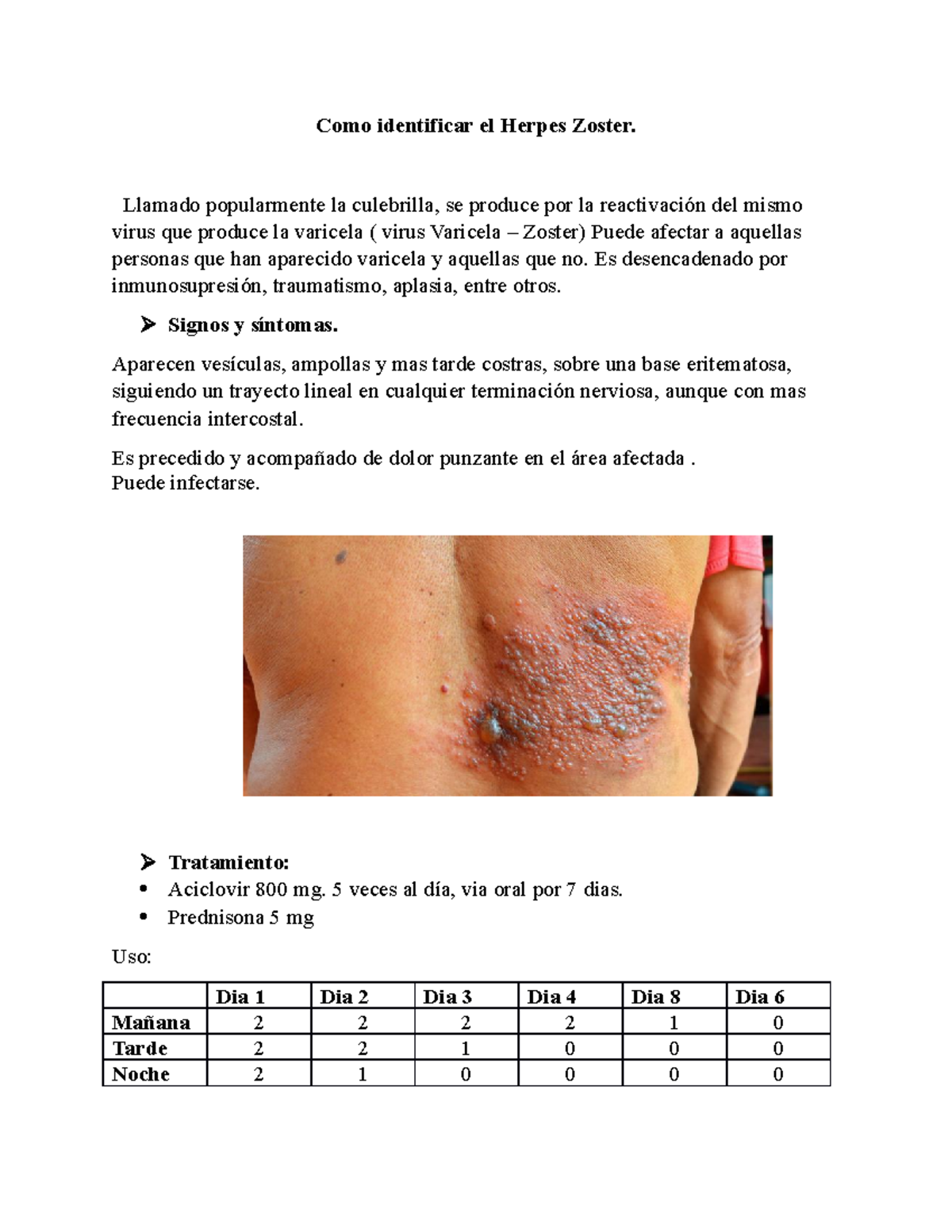 Como identificar el Herpes Zoster - Llamado popularmente la culebrilla, se produce por la del ...