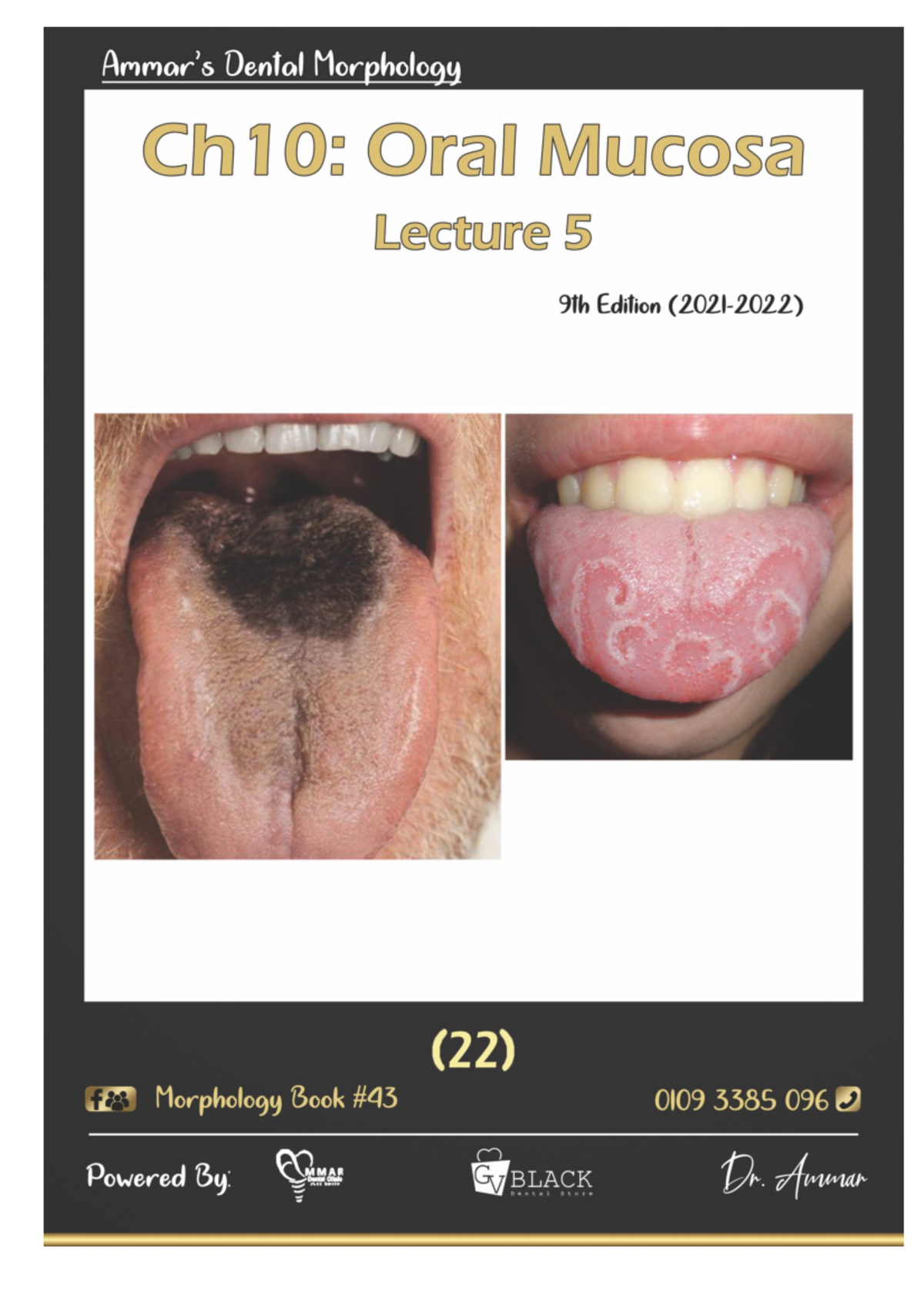 10 Oral Mucosa 5 - Oral biology - Ammar’s Oral Histology FB. Mahmoud ...