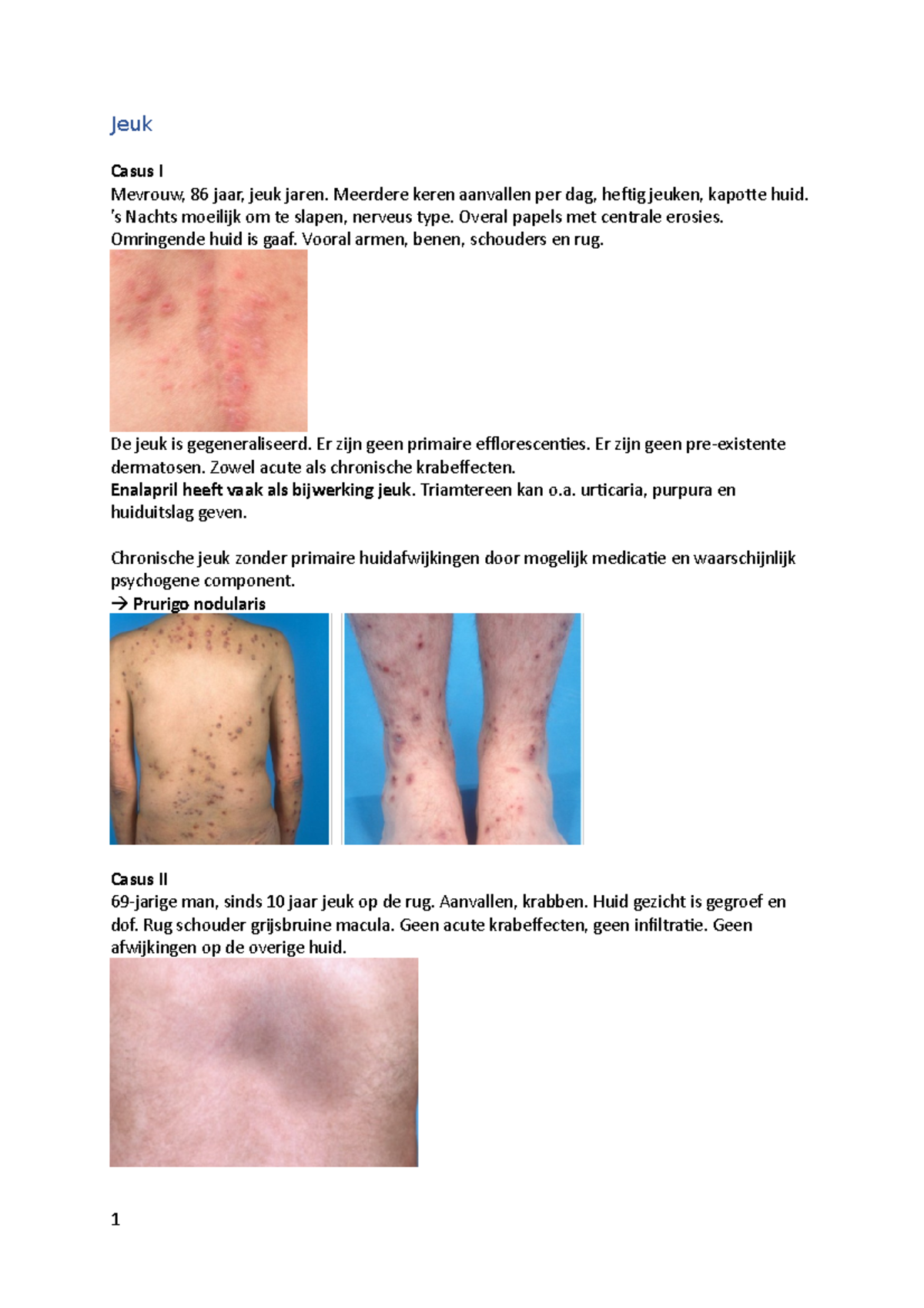 Jeuk - Verplichte e-learning jeuk - Jeuk Casus I Mevrouw, 86 jaar, jeuk ...