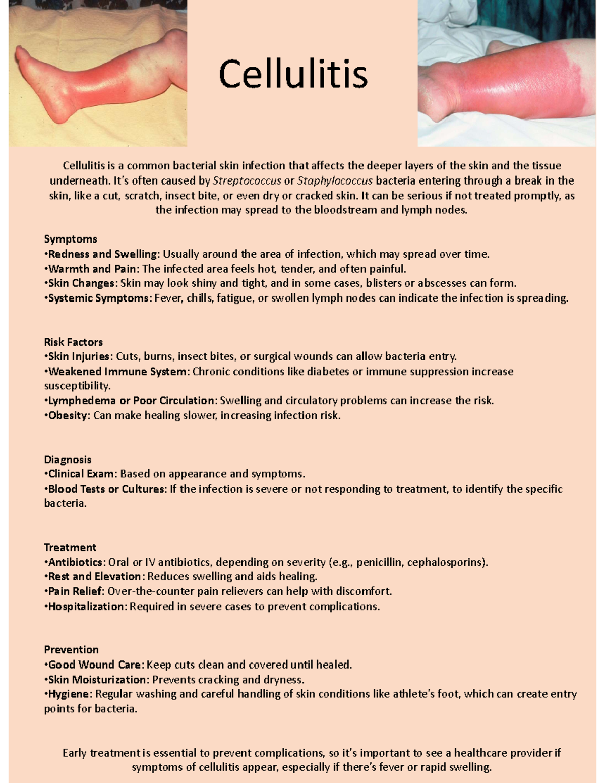 Cellulitis - Cellulitis Cellulitis is a common bacterial skin infection that affects the deeper ...