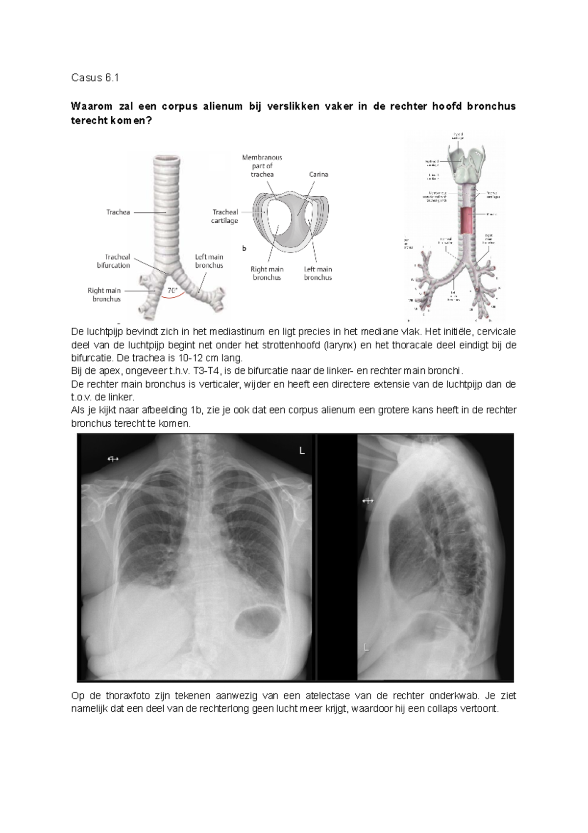 Casus 6.1 (Atelectase - corpus alienum) - Casus 6. Waarom zal een ...