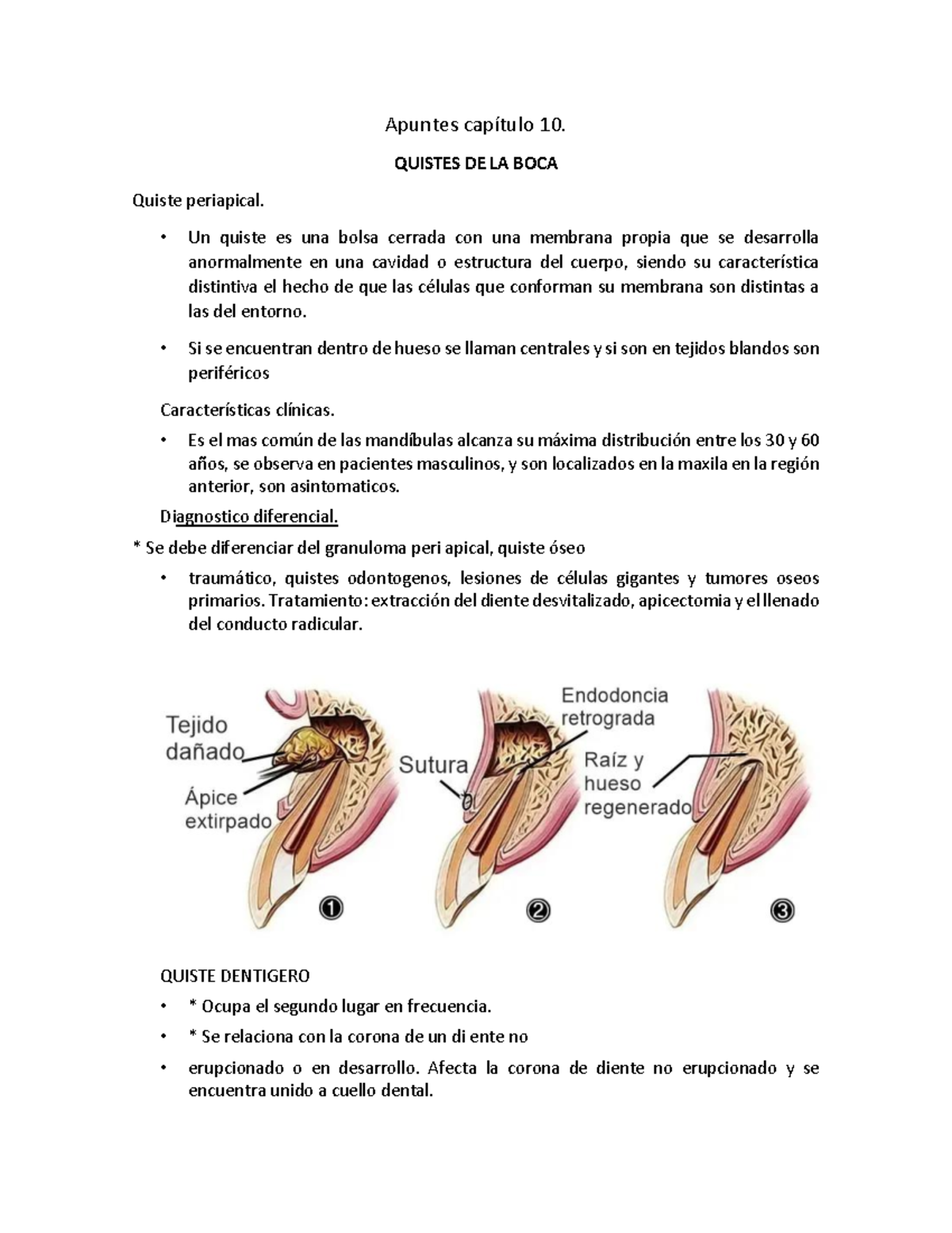 Apuntes capítulo 10 - QUISTES DE LA BOCA Quiste periapical. Un quiste ...