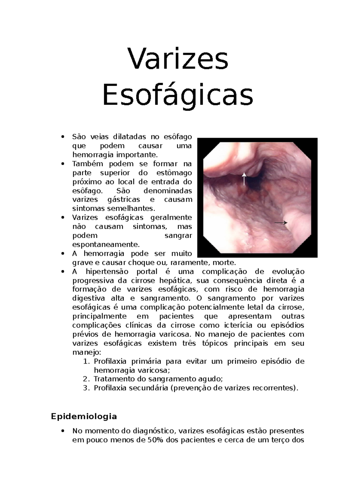 Varizes Esofágicas - RES - Varizes Esofágicas São veias dilatadas no ...