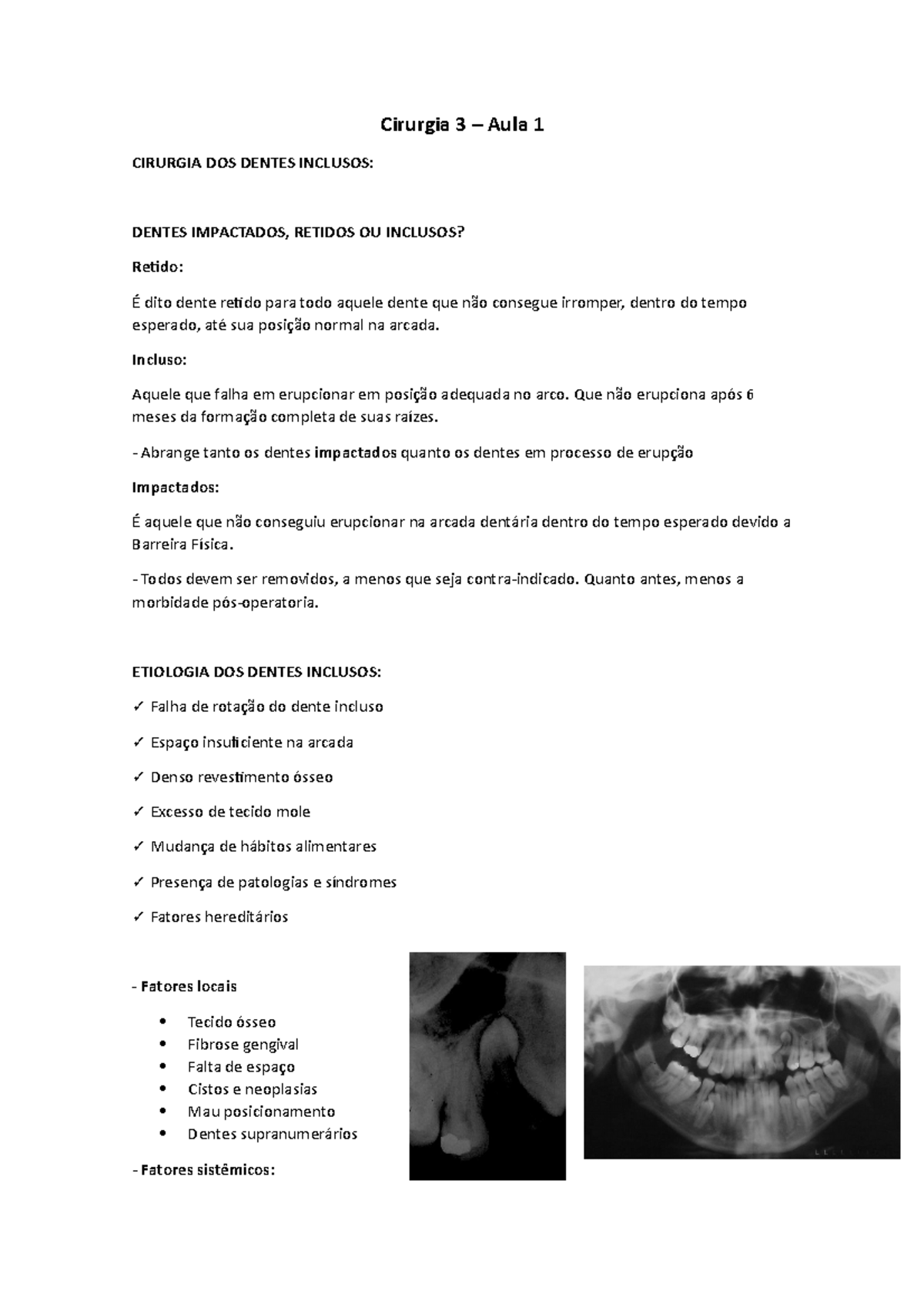 Cirurgia DOS Dentes Inclusos - Cirurgia 3 Aula 1 CIRURGIA DOS DENTES ...
