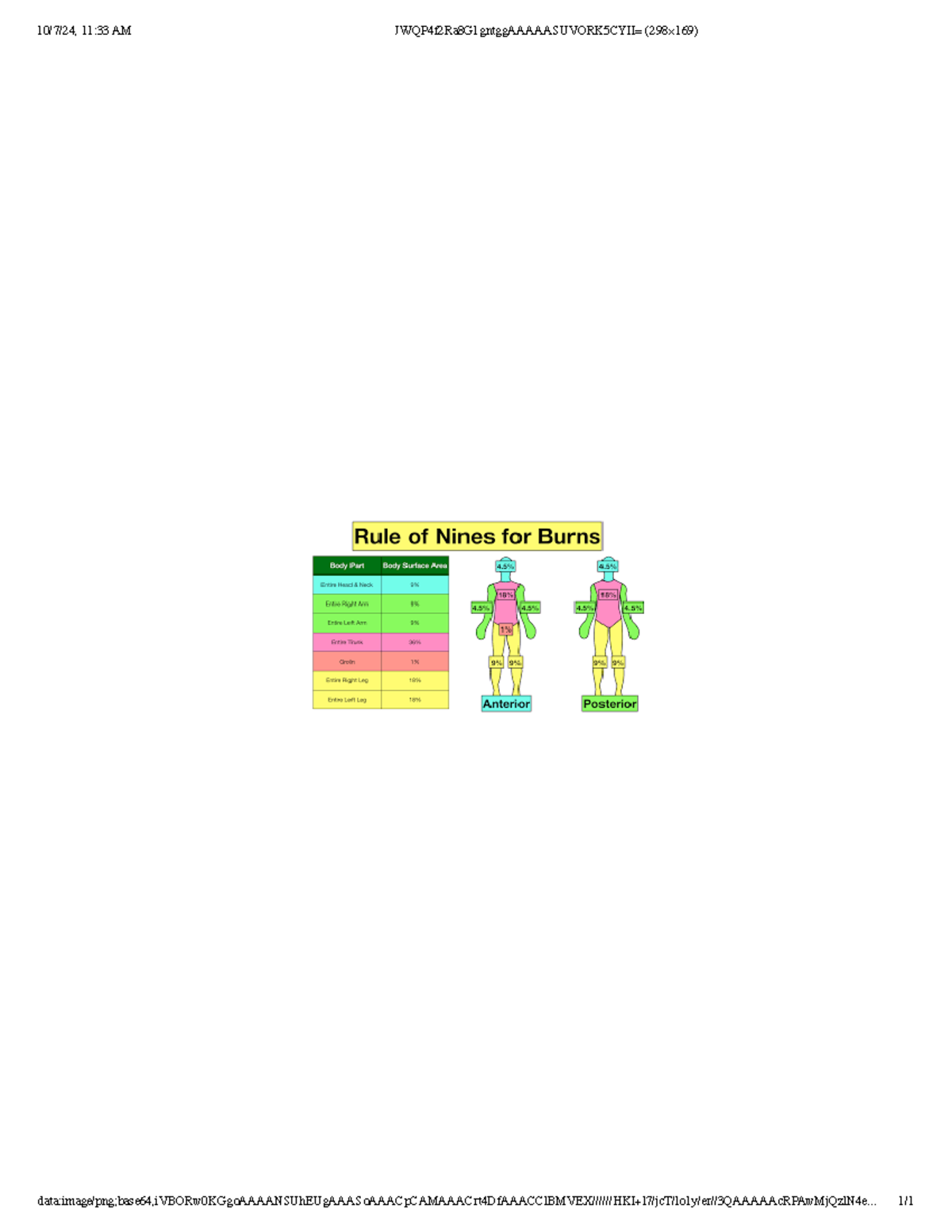 Rule of 9 - Burns Rule of 9 - NR-341 - Rule of Nines for Burns Body ...
