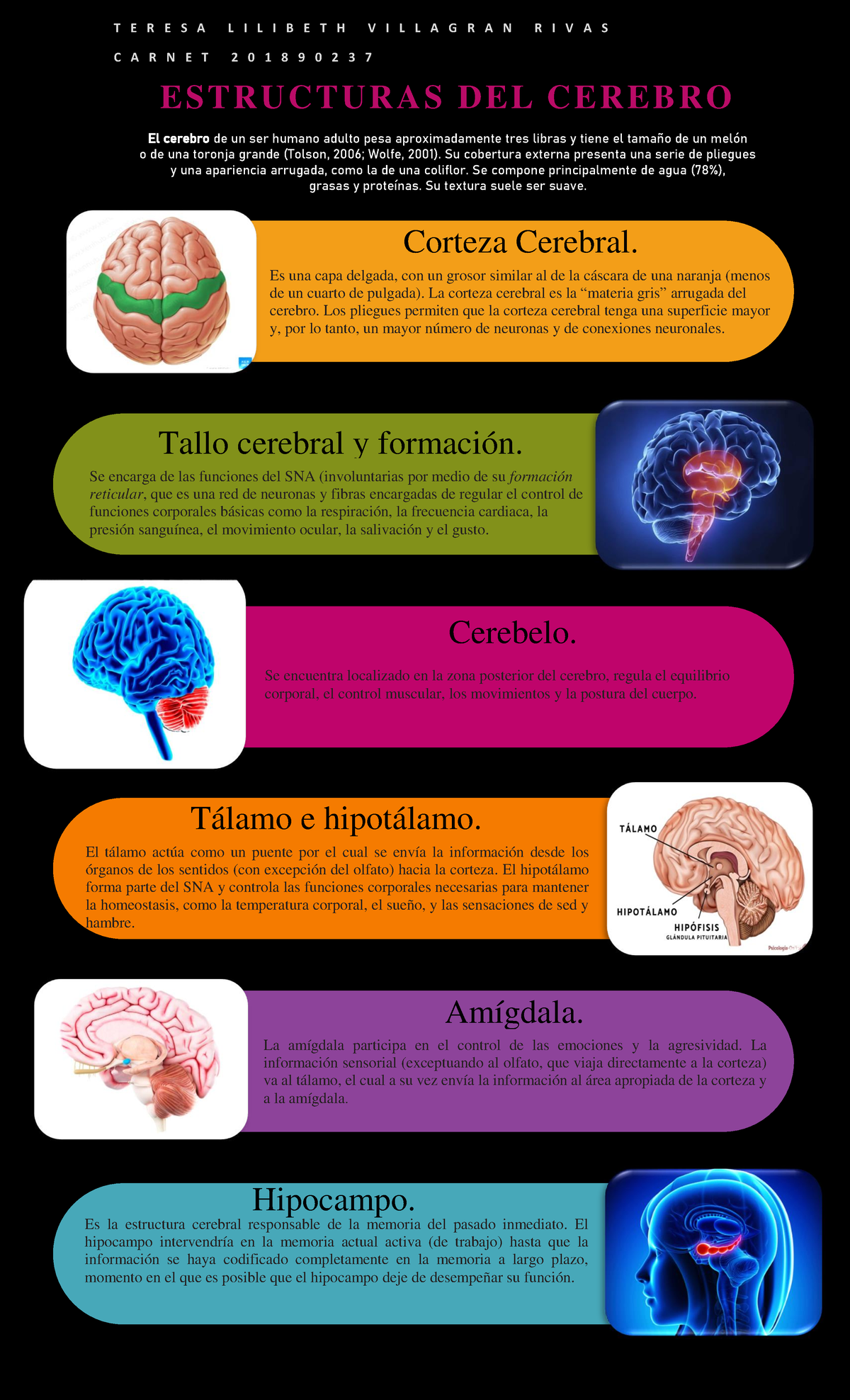 Infografía - E S T R U C T U R A S D E L C E R E B R O El cerebro de un ...