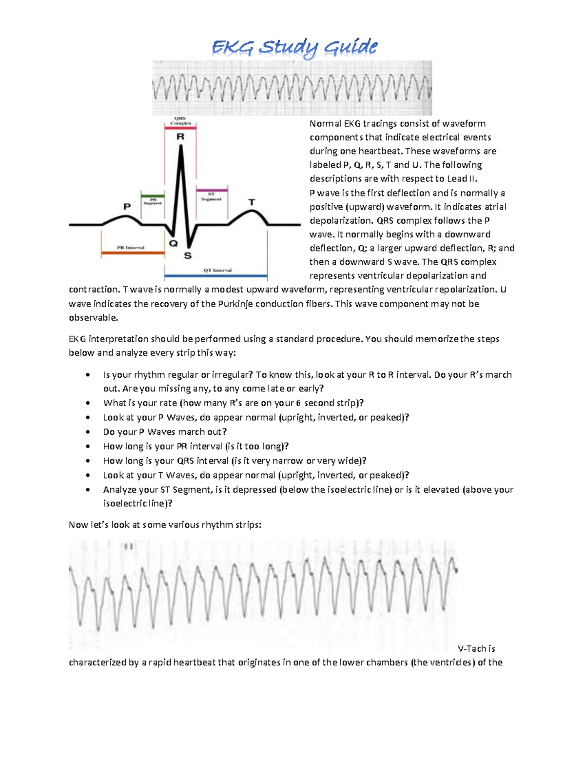 Ekg quick guide - ekg easy - Normal EKG tracings consist of waveform ...