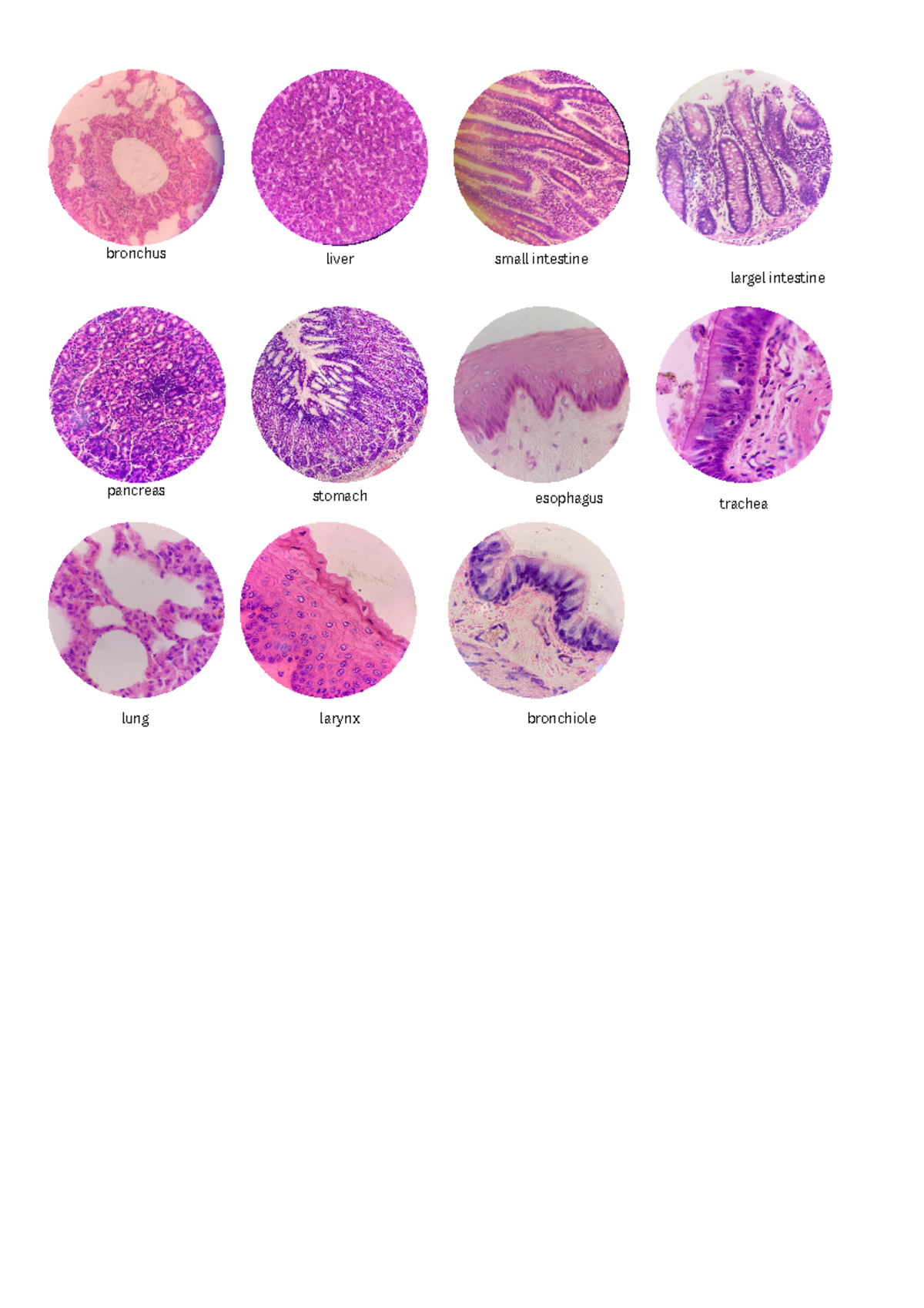 Bronchus - Microscope oio - Medical Laboratory Science - bronchus liver ...