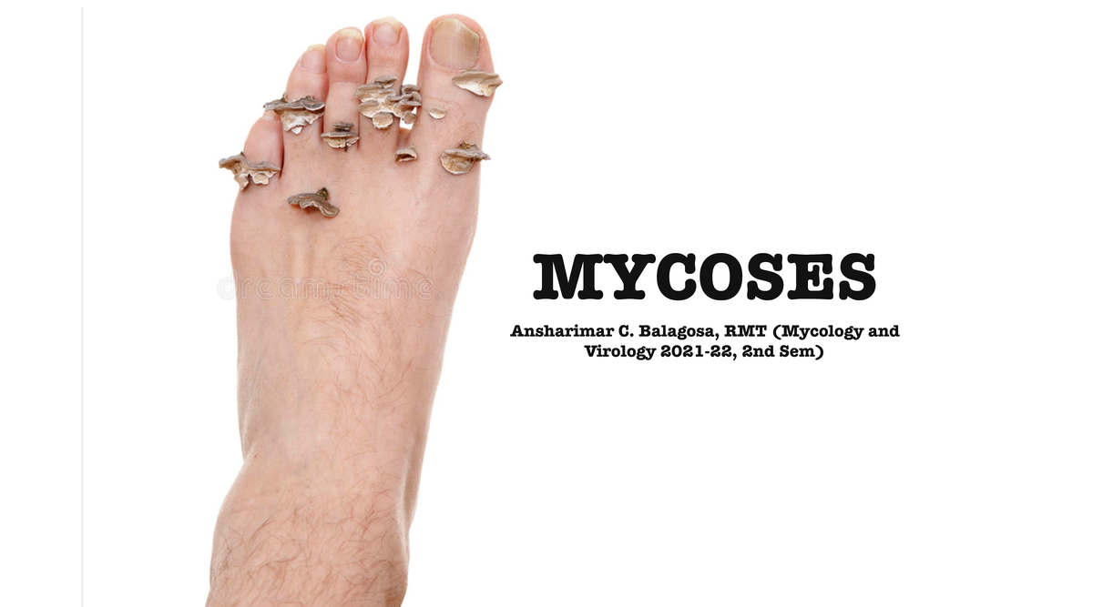 2- Intro and Superficial Mycoses( MycoViro Notes) - MYCOSES Ansharimar ...
