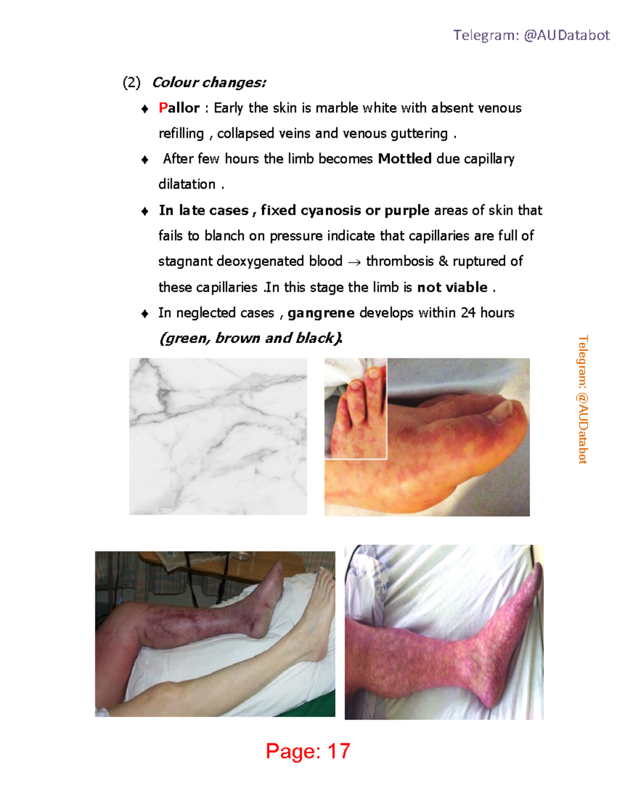 General surgery lecure notes 3 - (2) Colour changes: ⧫ Pallor : Early ...