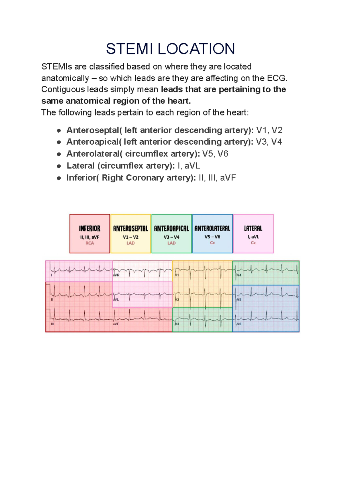 Grounds ekg - n/a - STEMI LOCATION STEMIs are classified based on where ...