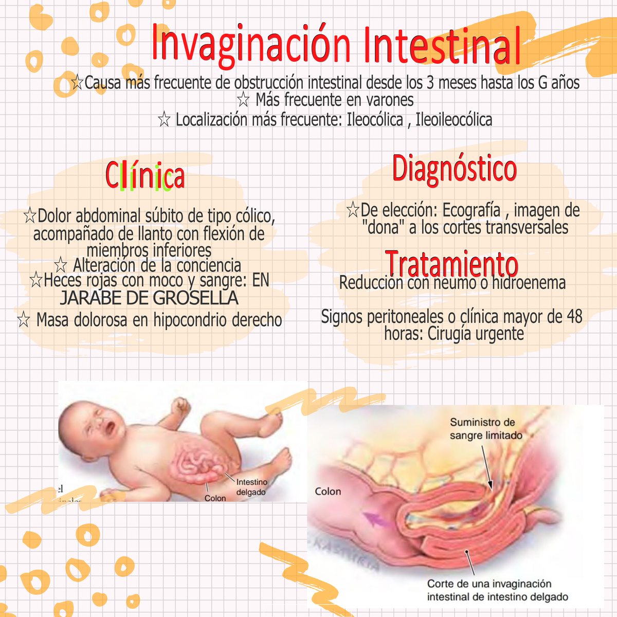 Invaginacion Intestinal - I n n n v a a a gi i i n a a a c i i i ó ó ó ...