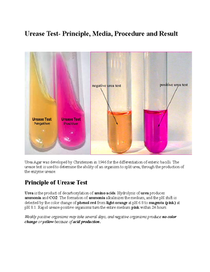Urease Test