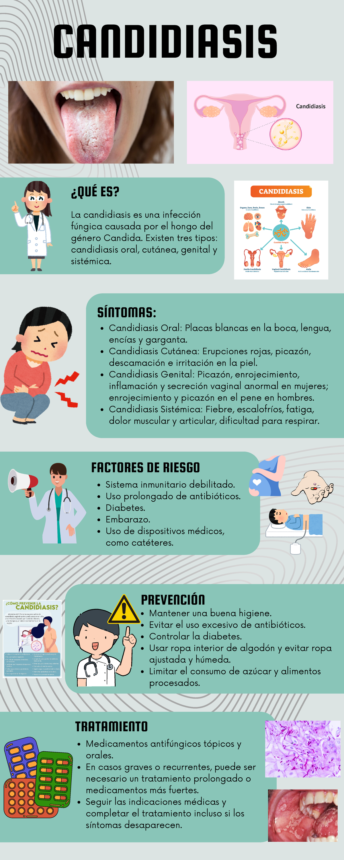 Candidiasis - Existen tres tipos: candidiasis oral, cutánea, genital y ...