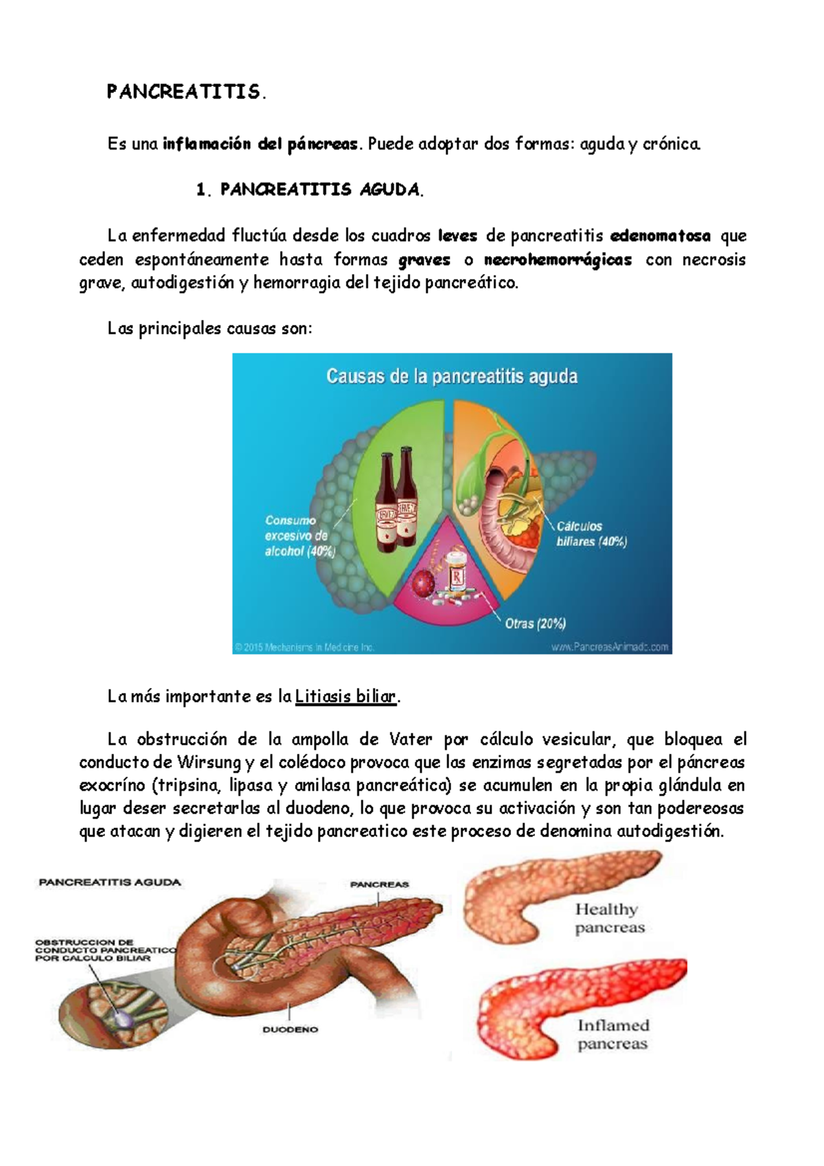 Pancreatitis - PANCREATITIS. Es una inflamación del páncreas. Puede ...