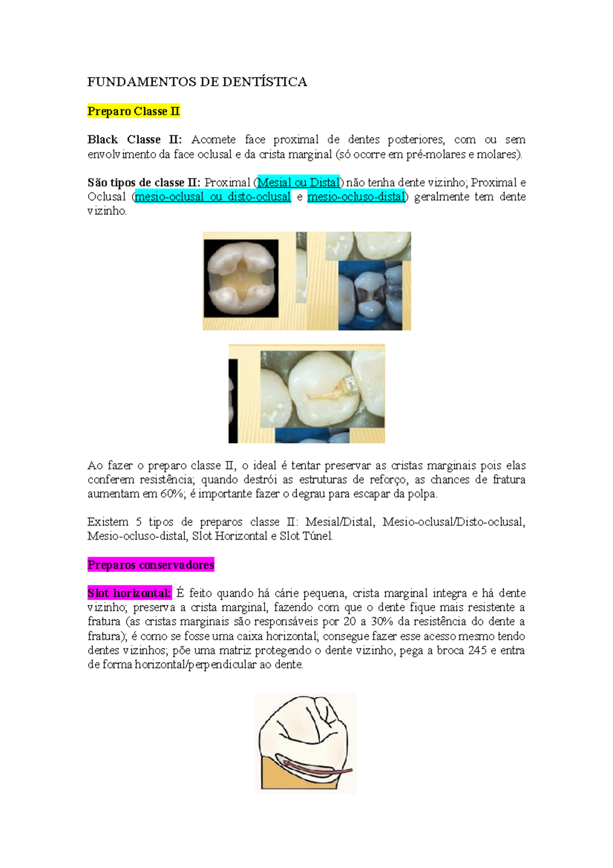 Aula 5 Preparo Classe II - FUNDAMENTOS DE DENTÍSTICA Preparo Classe II ...