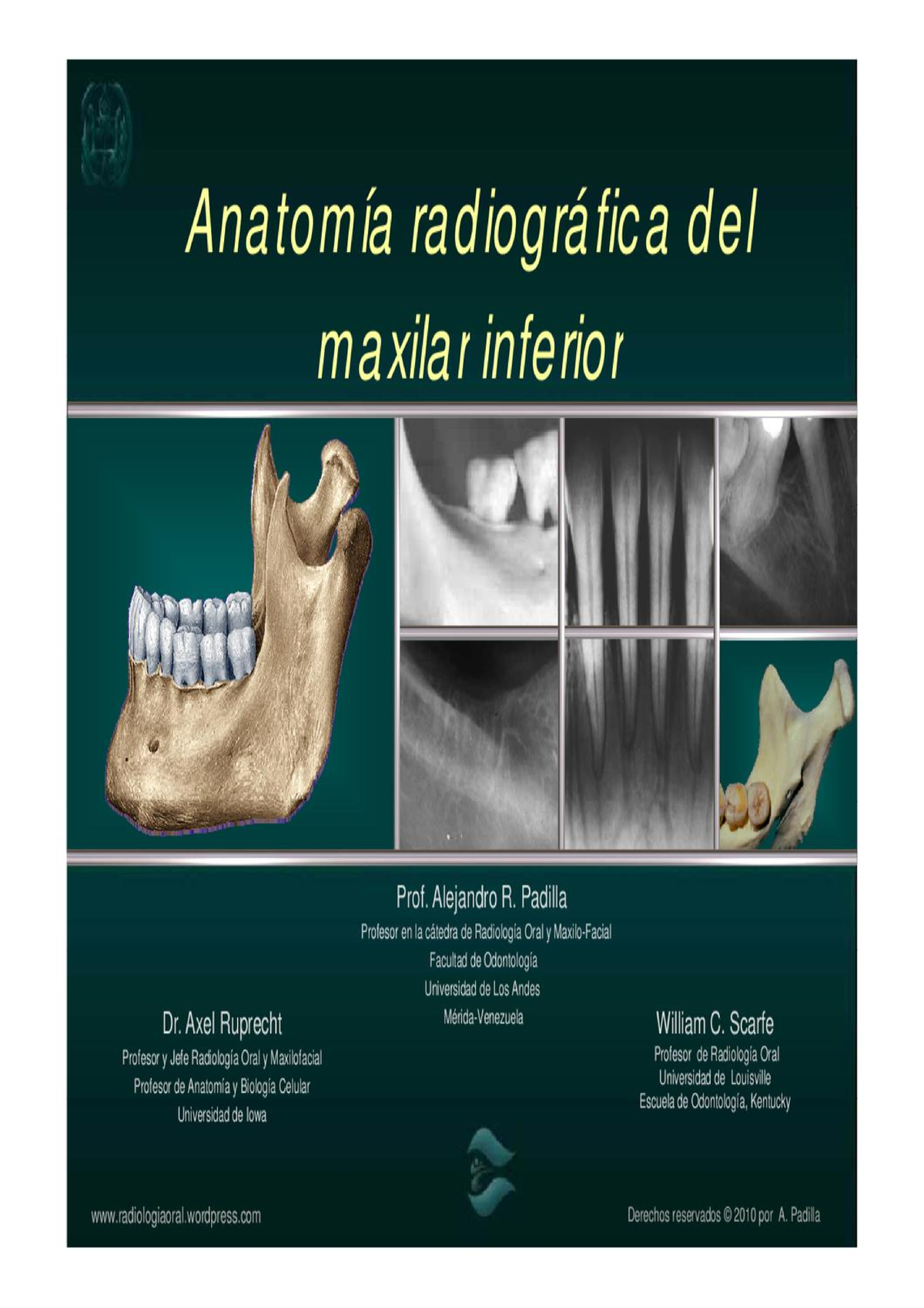 Anatomía humana radiográfica del maxilar inferior - Anatomía humana ...