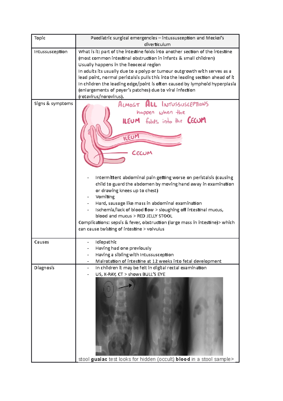 Paediatric surgical emergencies – intussusception and Meckel’s ...