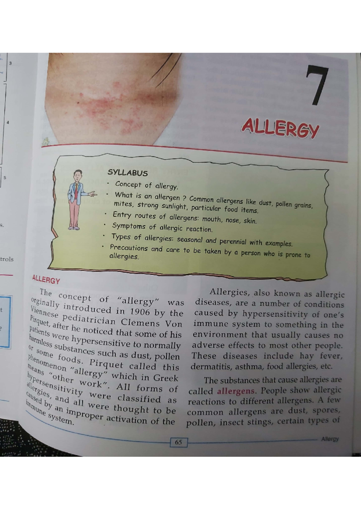 Allergy Class 7 - Bio notes but in short - Biomedical Sensors - Studocu