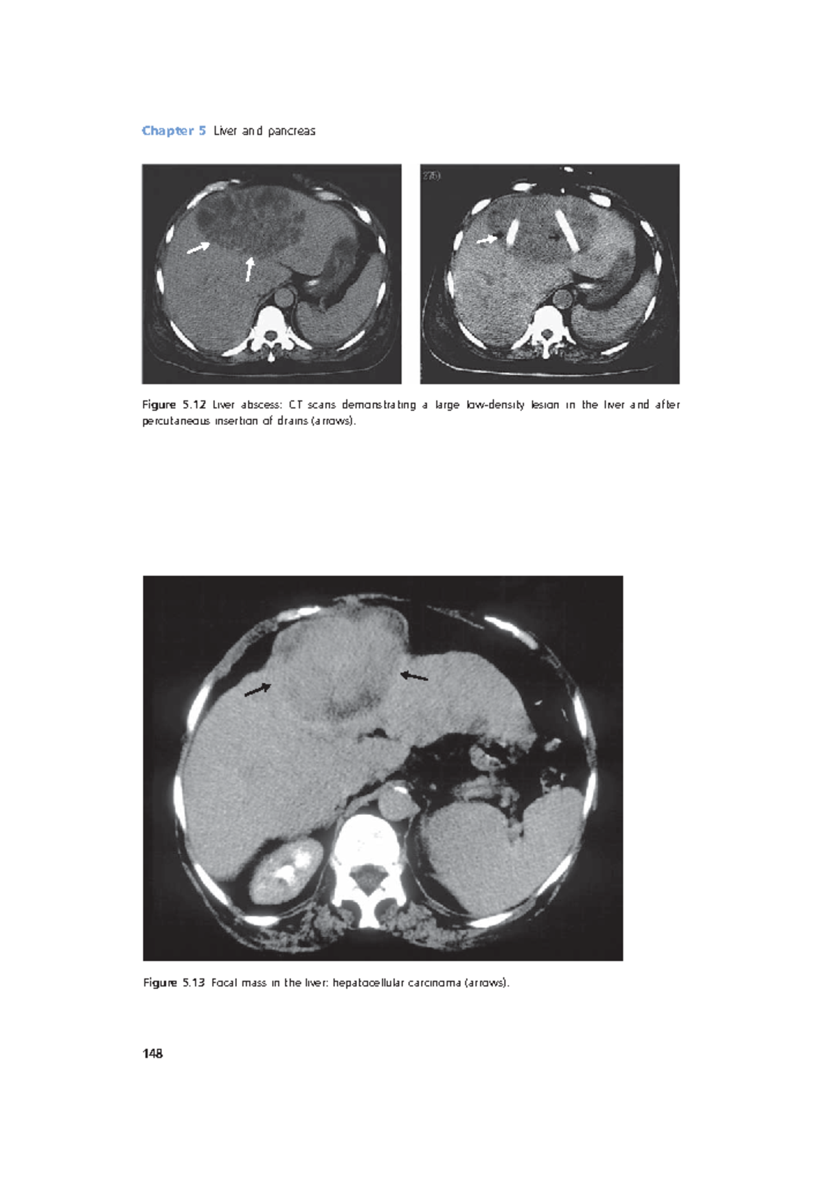 Radiology Lecture Notes pdf (50) - Chapter 5 Liver and pancreas 148 ...
