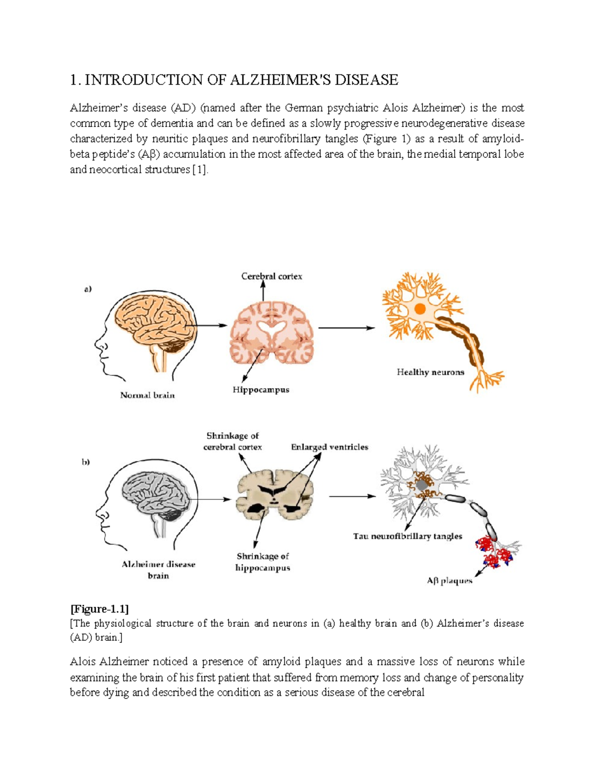 Alzhimer'S Disease - nothing to needed - 1. INTRODUCTION OF ALZHEIMER'S ...