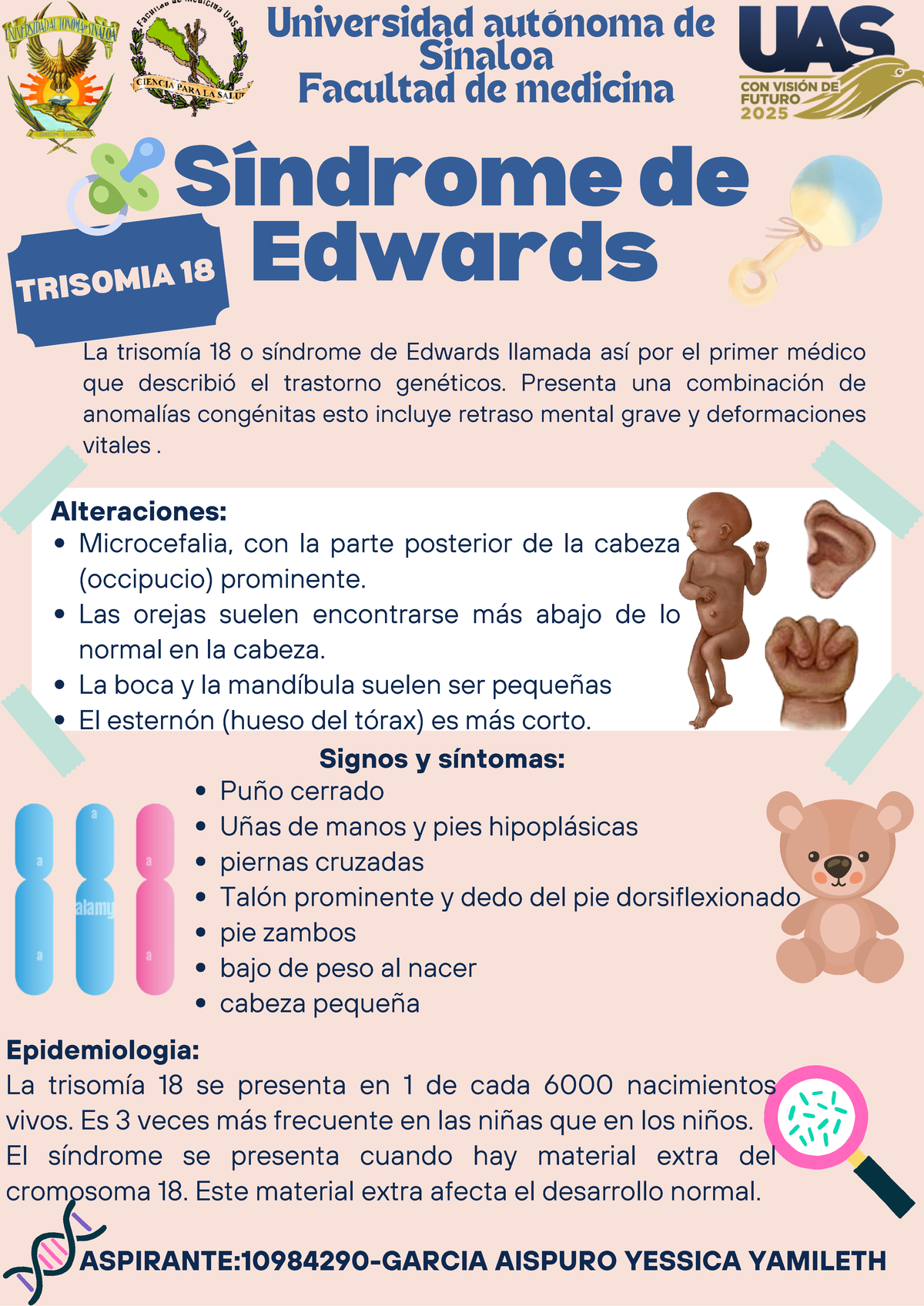 Síndrome de Edwards - Alteraciones: Microcefalia, con la parte ...
