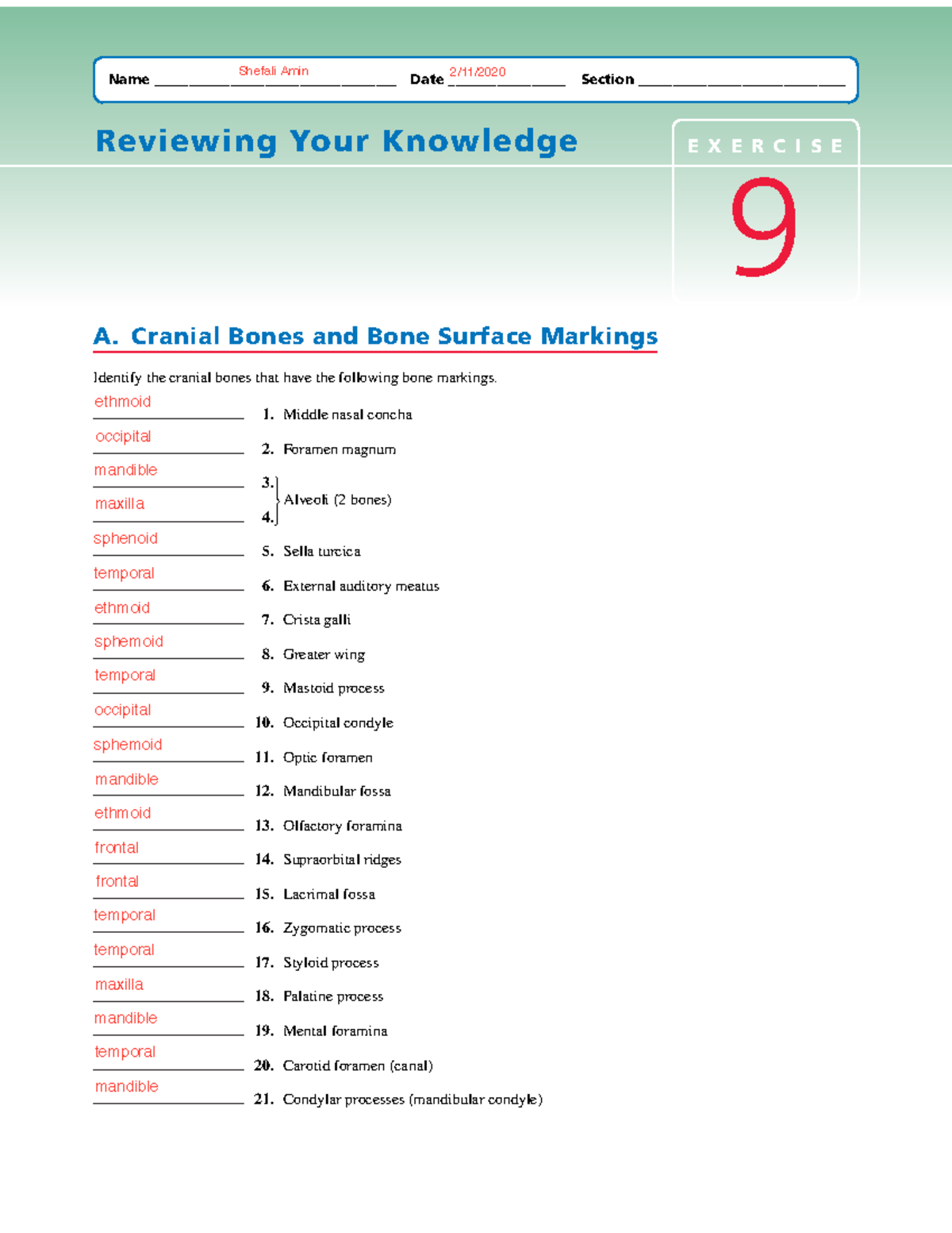 Reviewing your Knowledge Anatomy - A. Cranial Bones and Bone Surface ...