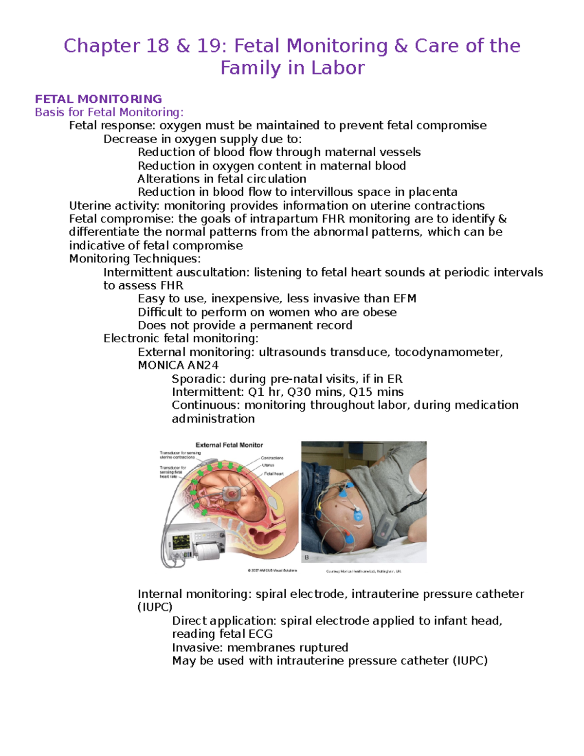 NUR 324 fetal monitoring - Chapter 18 & 19: Fetal Monitoring & Care of ...