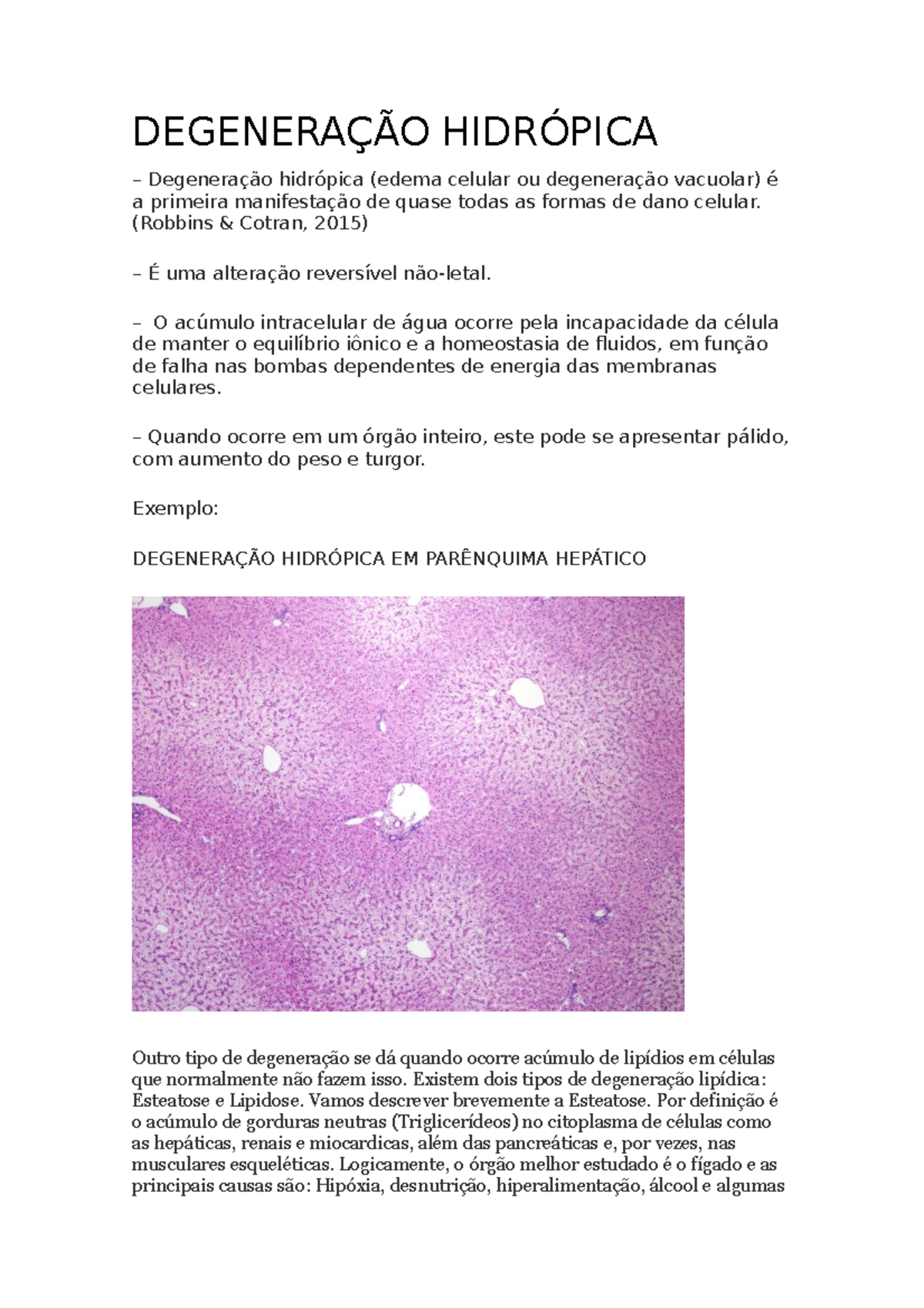 Degeneração Hidrópica 2022 tivane - DEGENERAÇÃO HIDRÓPICA Degeneração ...