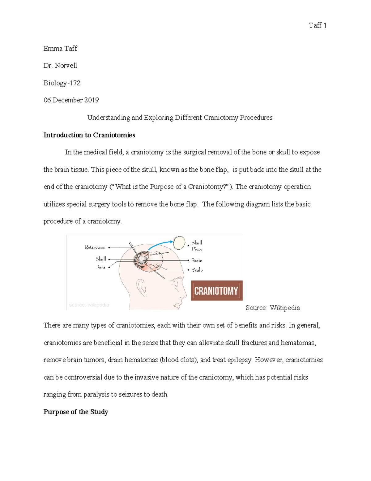 "Exploring Different Craniotomy Procedures" - Emma Taff Dr. Norvell ...