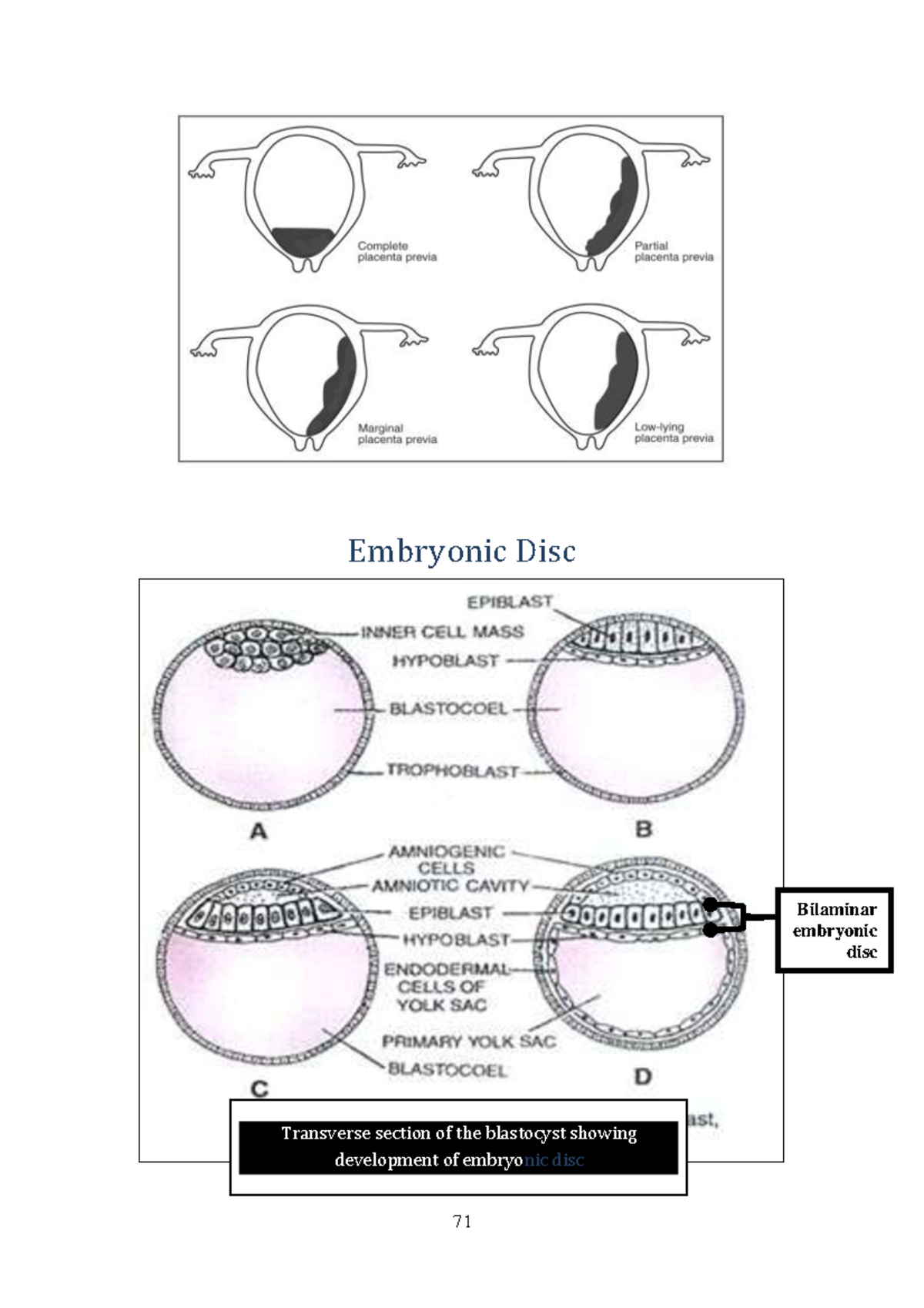 Emberyonic Disc - Embryonic disc anatomy and its clinically importance - Embryonic Disc ...