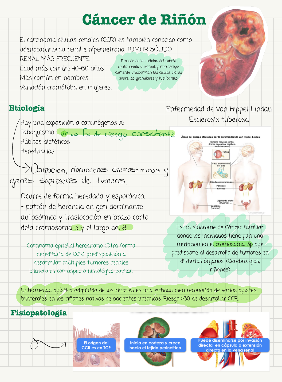 Ca Renal - Cáncer de Riñón El carcinoma células renales (CCR) es ...