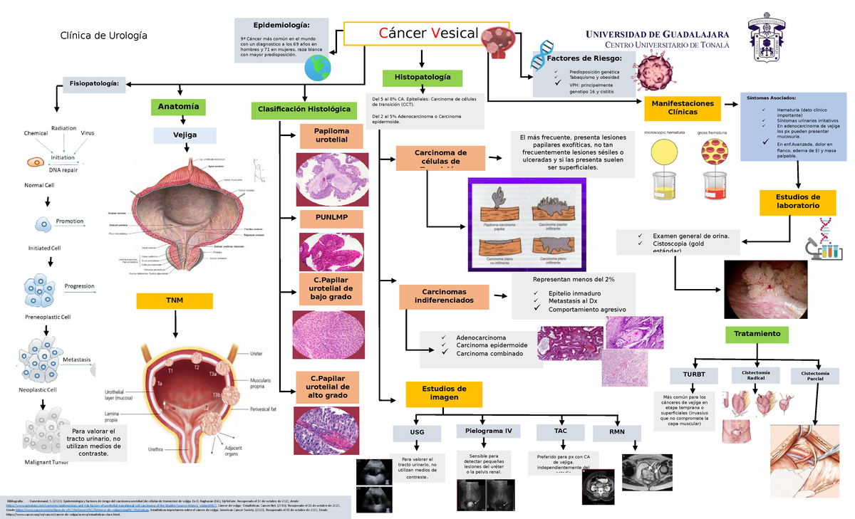 Cancer Vesical - Cáncer Vesical UNIVERSIDAD DE GUADALAJARA CENTRO ...
