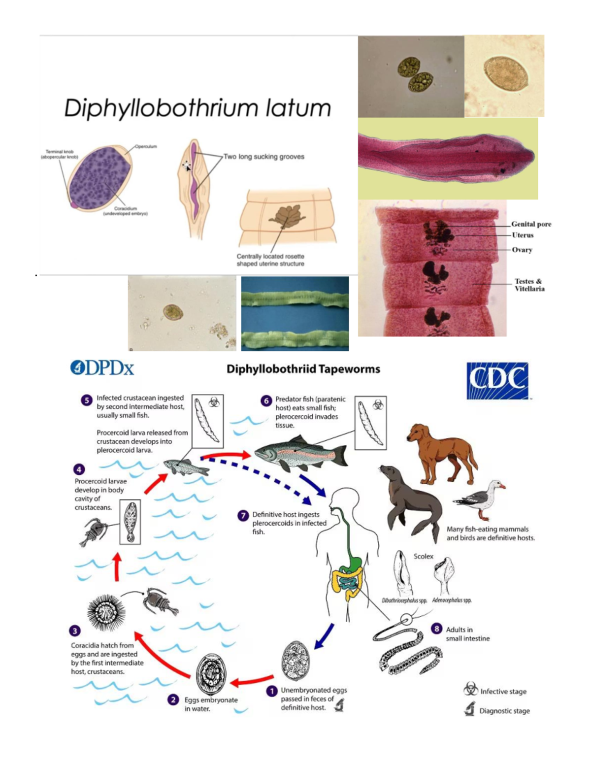 Para-final - notes - Diphyllobothrium latum Operculum Terminal knob ...