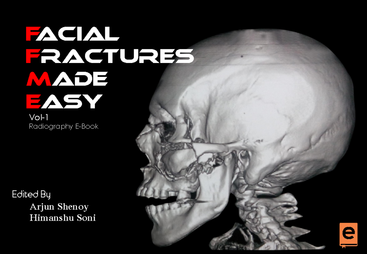 Facial Fractures Made Easy - FACIAL FRACTURES MADE EASY Edited By Arjun ...