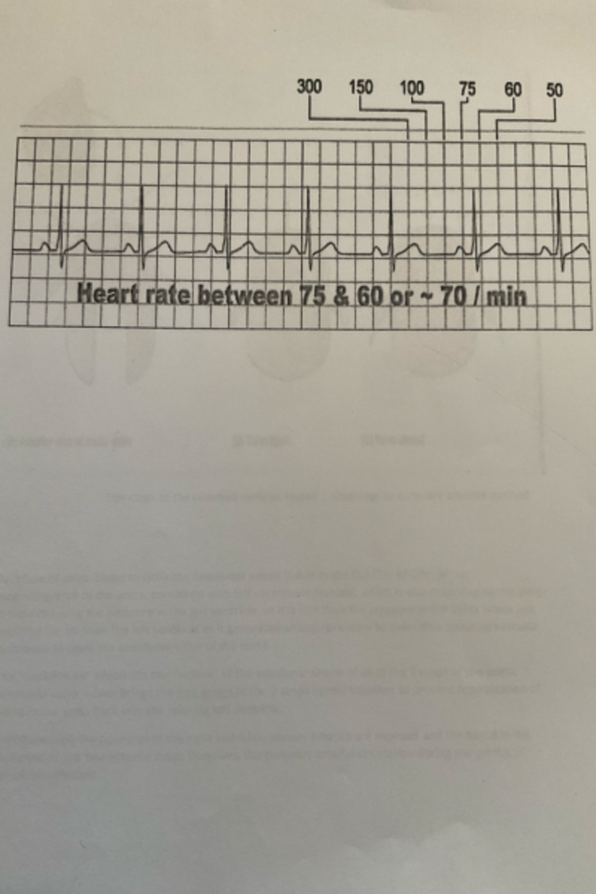 EKG diagram - BIOL 228L - 300 150 100 75 60 50 Heart rate between 75 ...