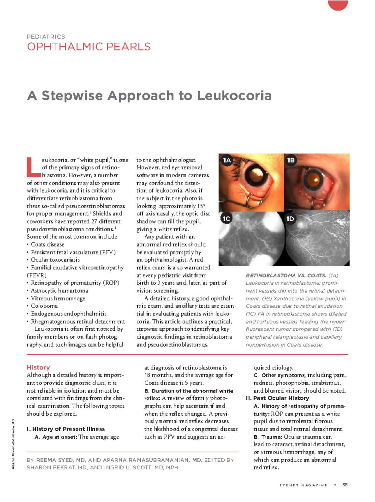 July 2016 Ophthalmic Pearls - EYENET MAGAZINE • 35 Aparna Ramasubramanian, MD A Stepwise ...
