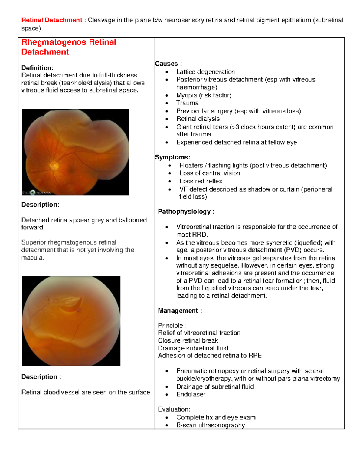 Retinal Detachment - Summary Clinical Ophthalmology: A Systematic ...